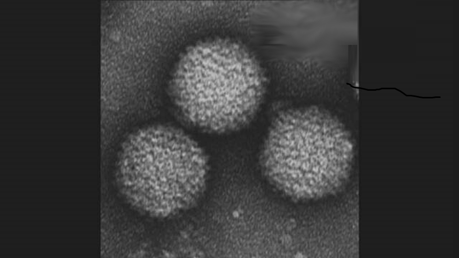 Japón registra un anómalo aumento de enfermedades infecciosas entre ...